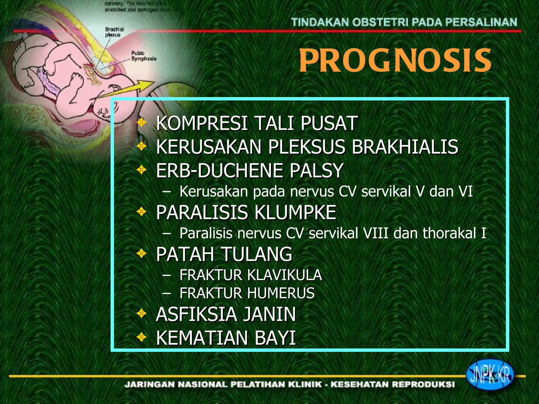 03 distosia bahu | PPT