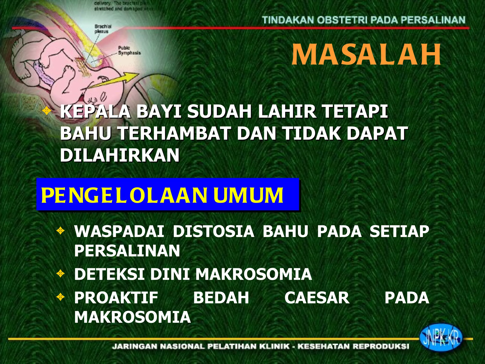 03 distosia bahu | PPT