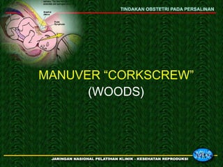 03 distosia bahu | PPT