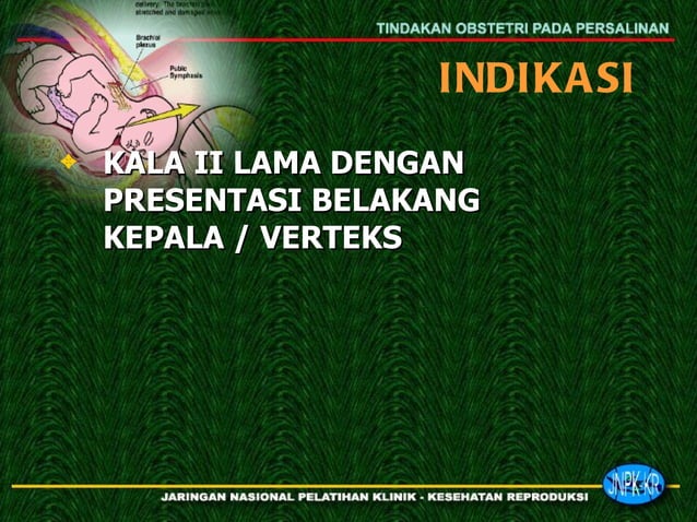 03 distosia bahu | PPT