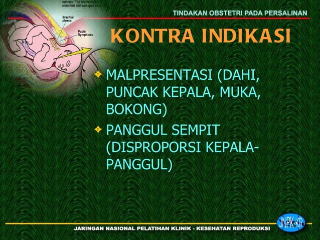 03 distosia bahu | PPT