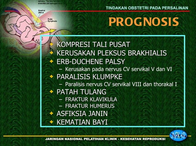 03 distosia bahu | PPT