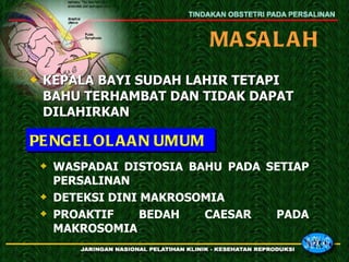 03 distosia bahu | PPT