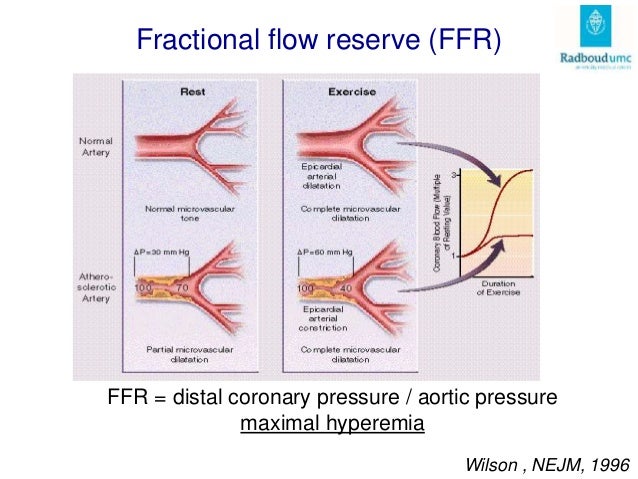 03 FFR Van Royen aimradial2017 - Pd/Pa and iFR