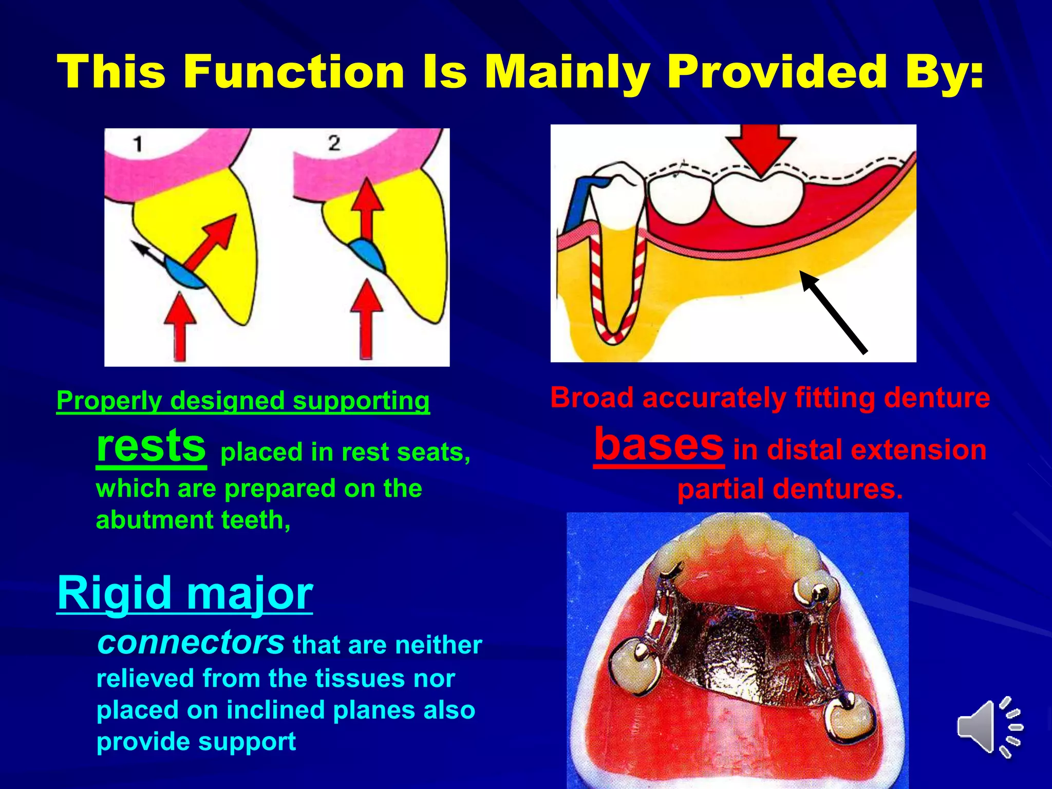 Forces acting on Removable Partial Denture | PPTX