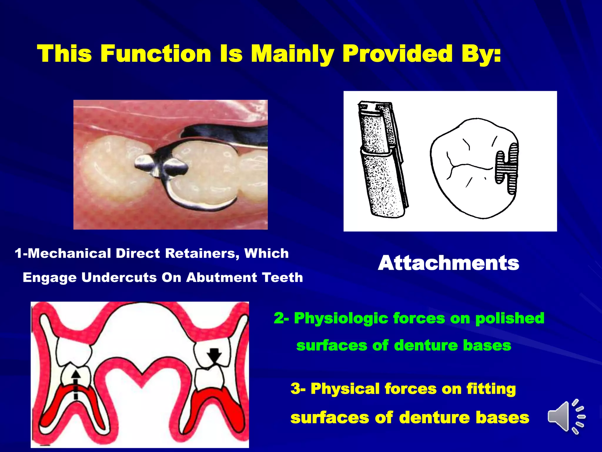 Forces acting on Removable Partial Denture | PPTX