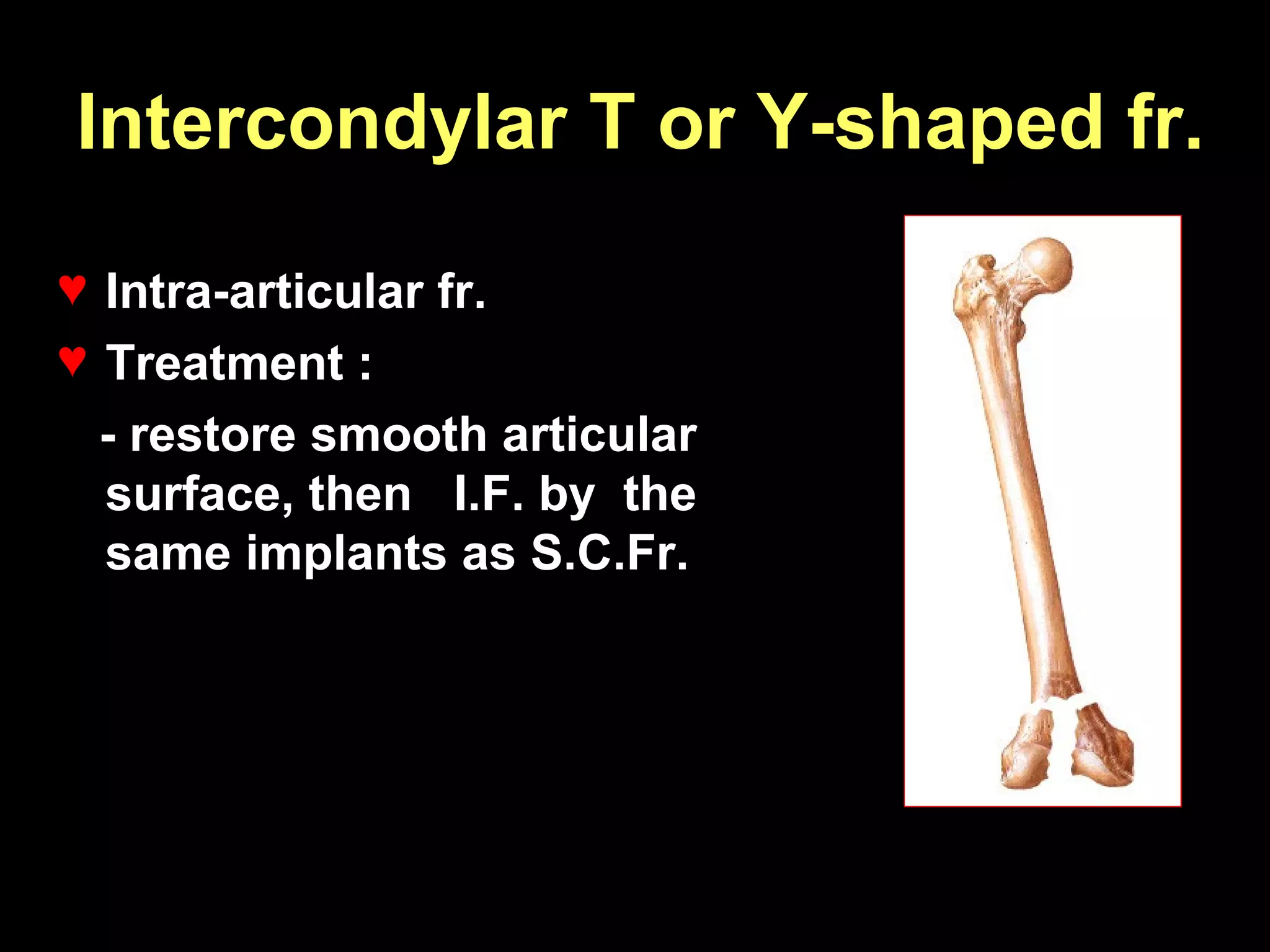 Fracture of Lower Limb and Pelvis | PPT