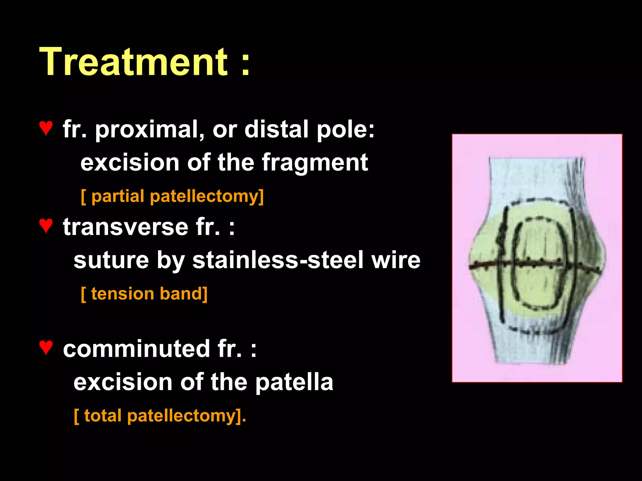 Fracture of Lower Limb and Pelvis | PPT