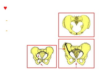 Fracture of Lower Limb and Pelvis | PPT