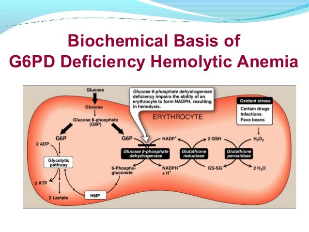 03 g6 pd deficiency