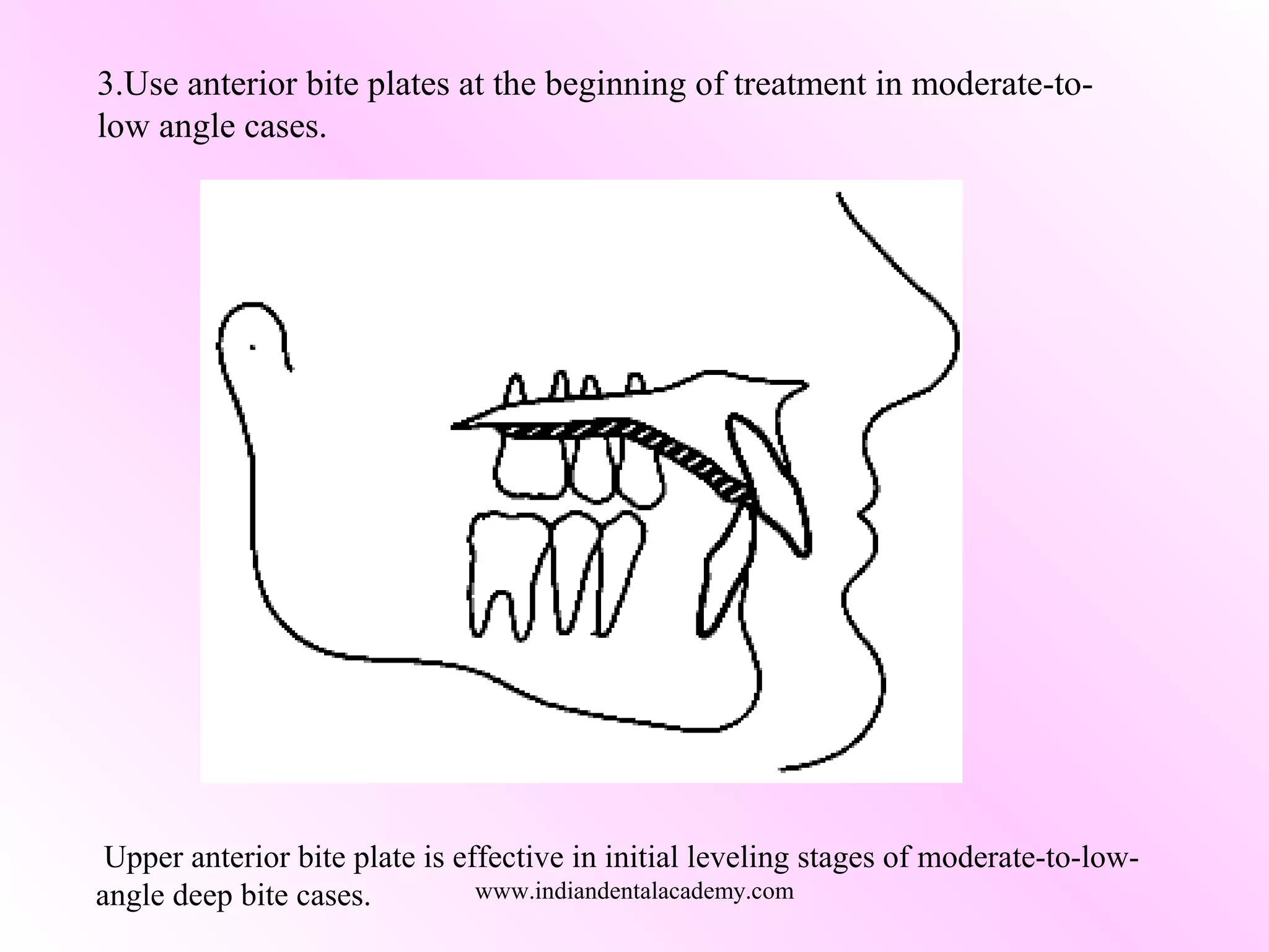 03 management of deep overbite in p readjusted appliance | PPT