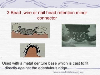 minor connectors | PPT