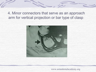 minor connectors | PPT