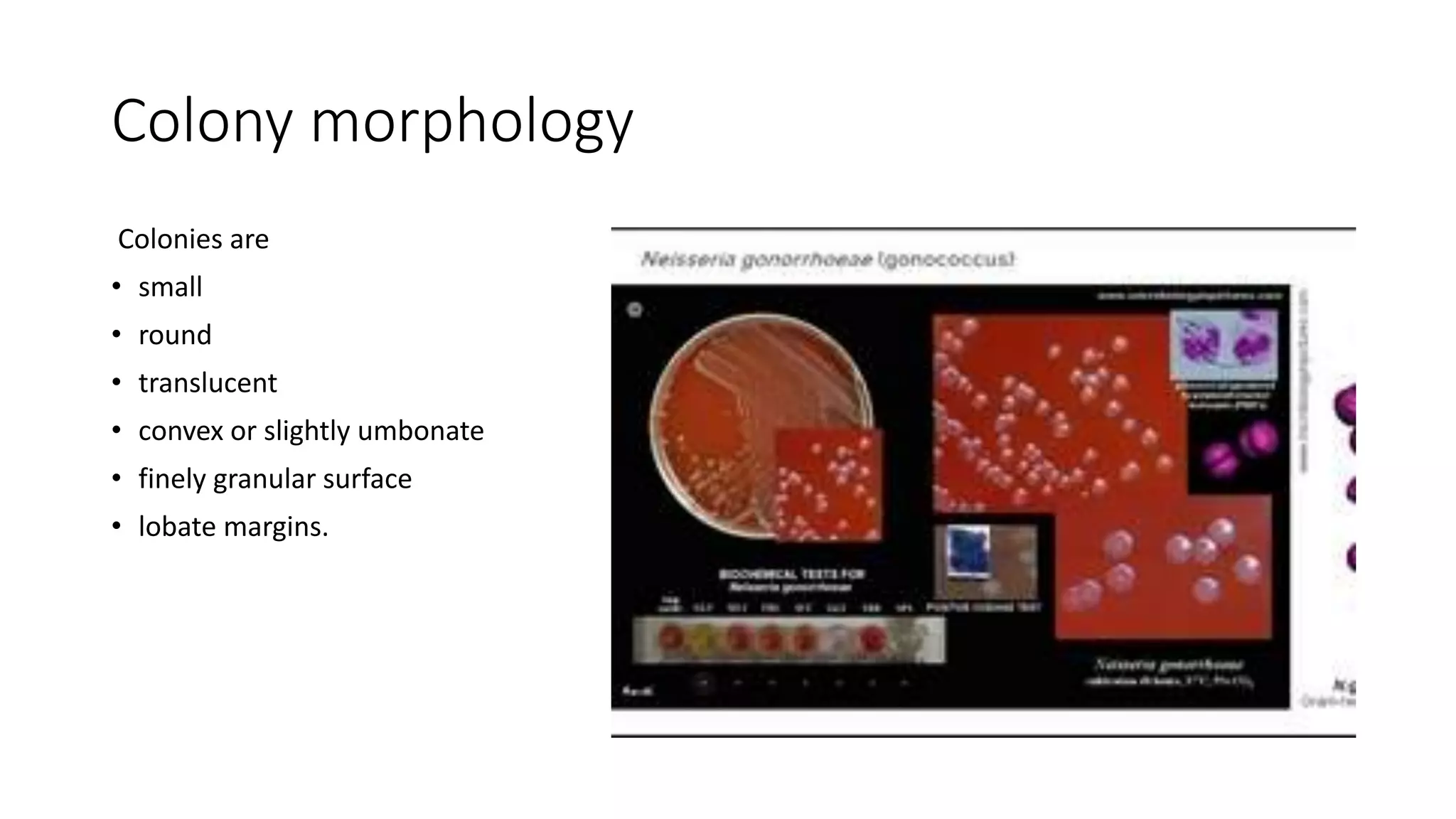 Neiserria gonorrhoeae | PPTX
