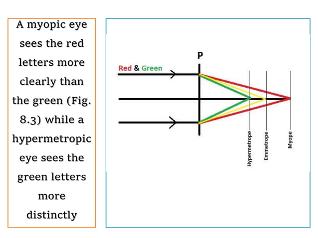 03 physiological optical defects | PPTX | Photography | Arts and Crafts
