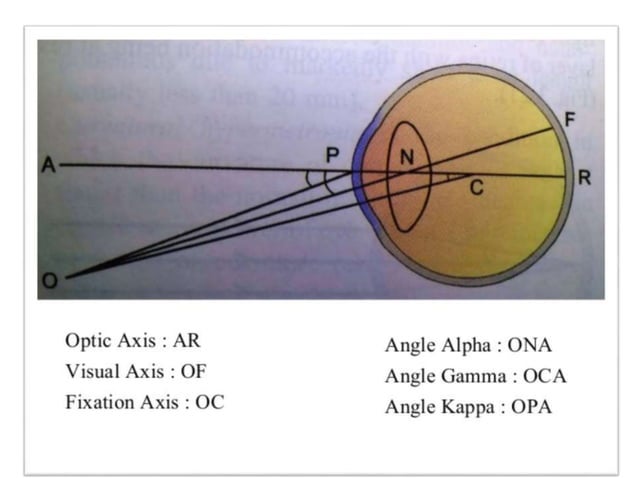 03 physiological optical defects | PPTX | Photography | Arts and Crafts