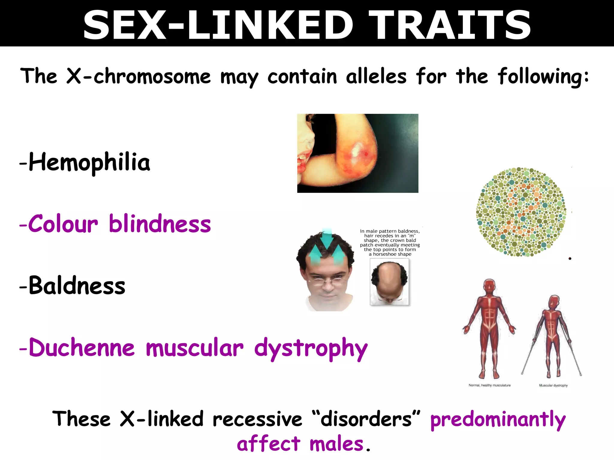03 sex linked inheritance | PPT