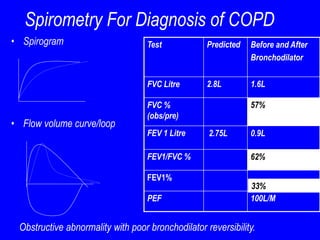 03 spirometry basics.ppt