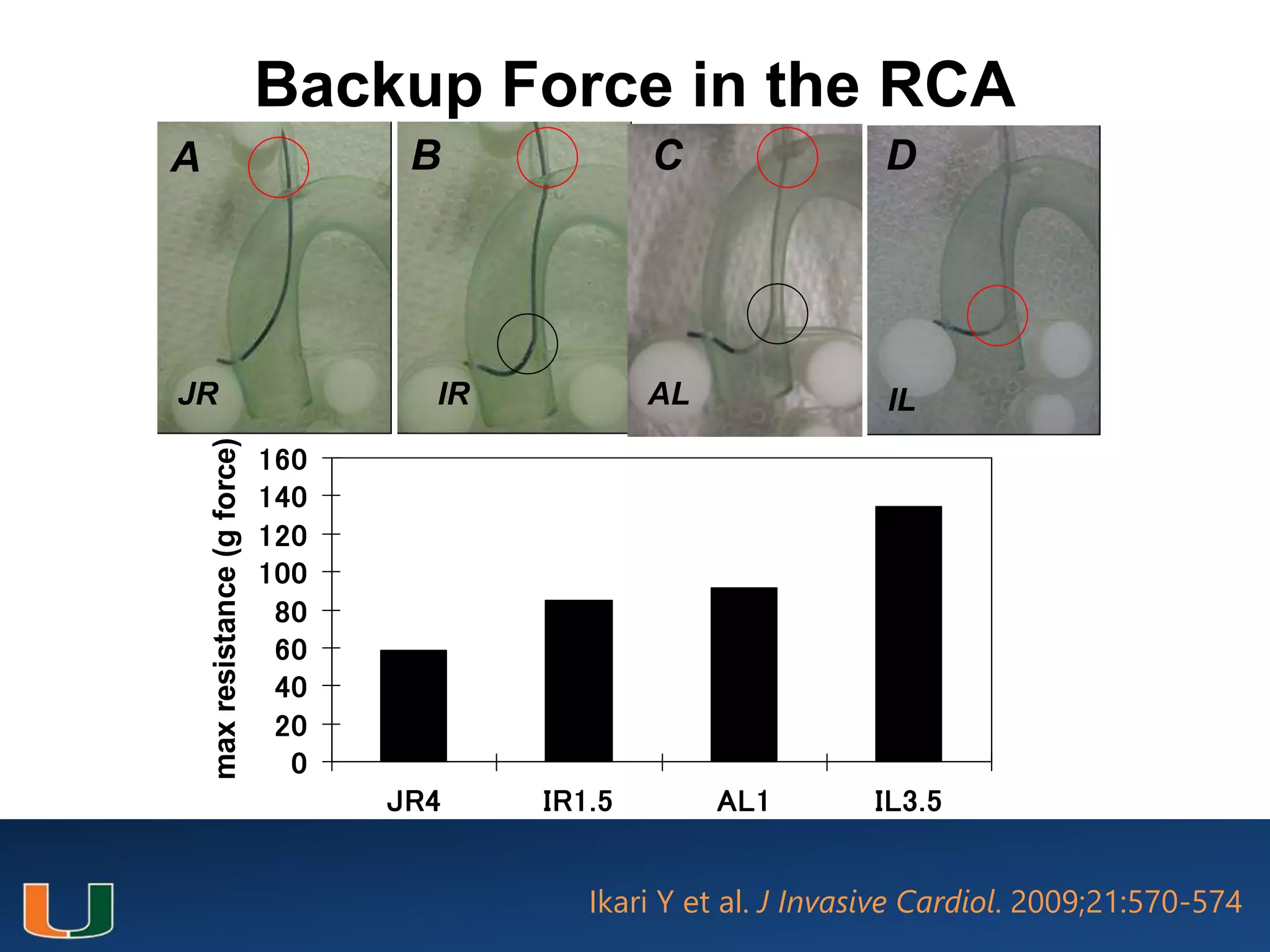 03 technical Cohen aimradial20170922 Guiding catheters | PPTX