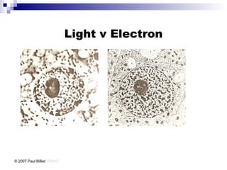 the light_electron microscopy] | PPT