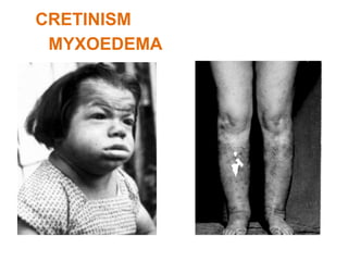 THYROID HORMONES & ANTI THYROID DRUGS | PPT