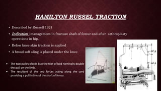 03 traction ppt | PPT