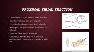03 traction ppt | PPTX