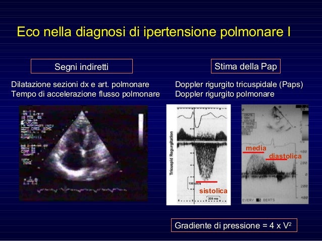 L'ipertensione polmonare:come diagnosticarla e trattarla