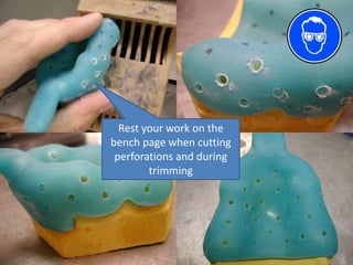 Upper partial special tray | PPTX