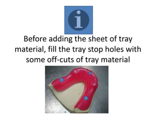 Upper partial special tray | PPTX