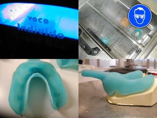 Upper partial special tray | PPTX