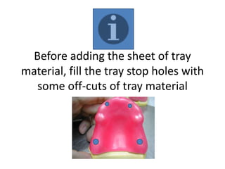 Upper partial special tray | PPTX