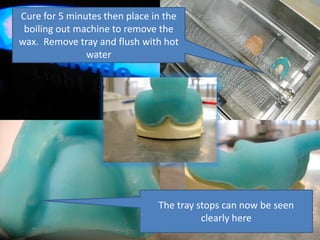 Upper partial special tray | PPTX