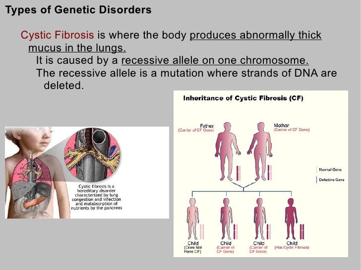 Genetic Disorders Chromosomes