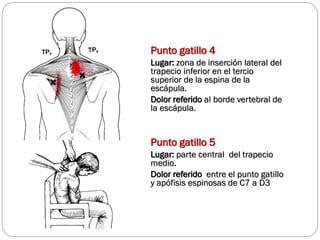 04. smf trapecio prv | PDF