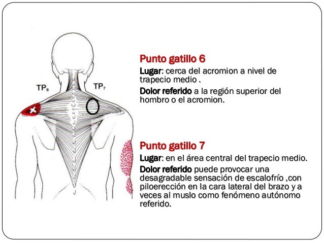 04. smf trapecio prv