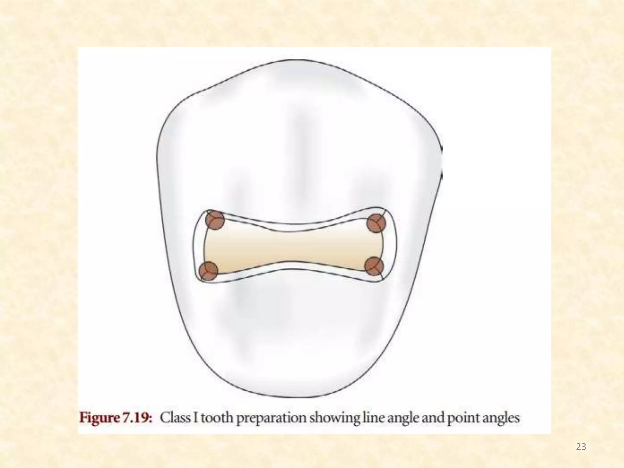 04.principles of tooth preparation | PPTX