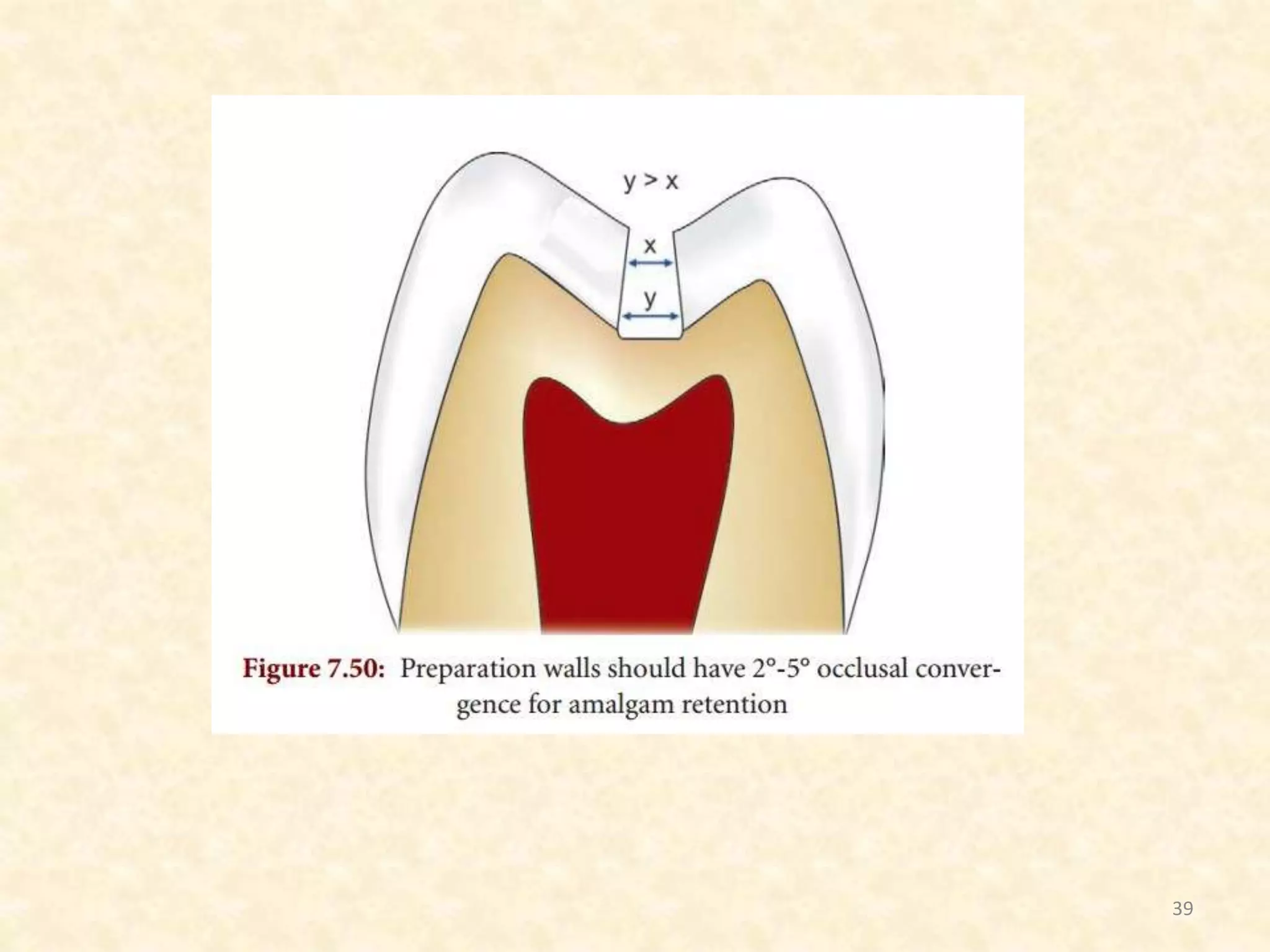 04.principles of tooth preparation | PPTX | Dental Health | Diseases and Conditions