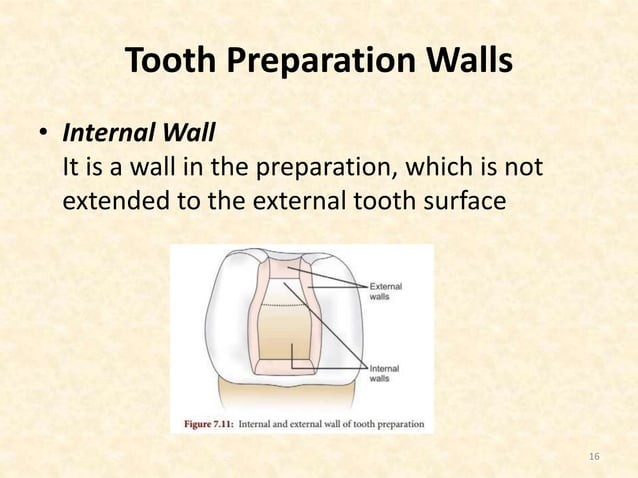 04.principles of tooth preparation | PPTX | Dental Health | Diseases and Conditions