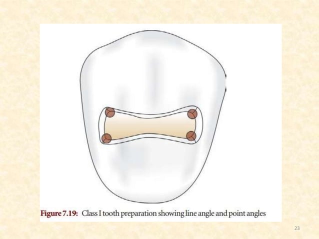 04.principles of tooth preparation | PPTX | Dental Health | Diseases and Conditions