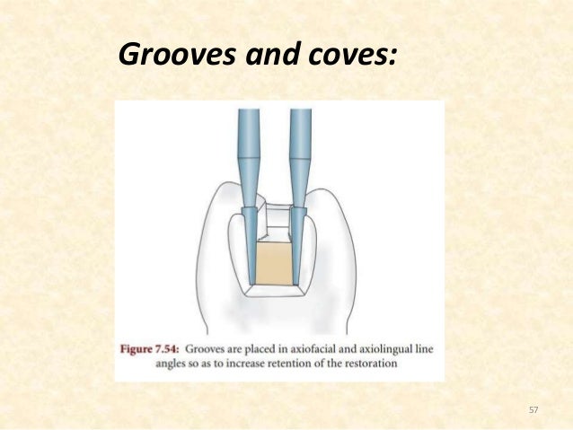 04.principles of tooth preparation