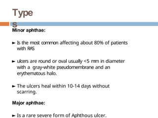 Gingival infections Gingival infections Gingival infections | PPT