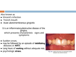 Gingival infections Gingival infections Gingival infections | PPT
