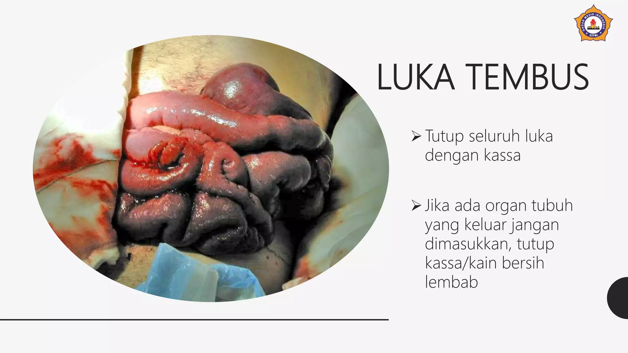 04. penatalaksanaan pasien trauma revisi | PPTX