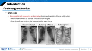 Multi-energy Bone Subtraction in Chest Radiography by Eigenvalue ...