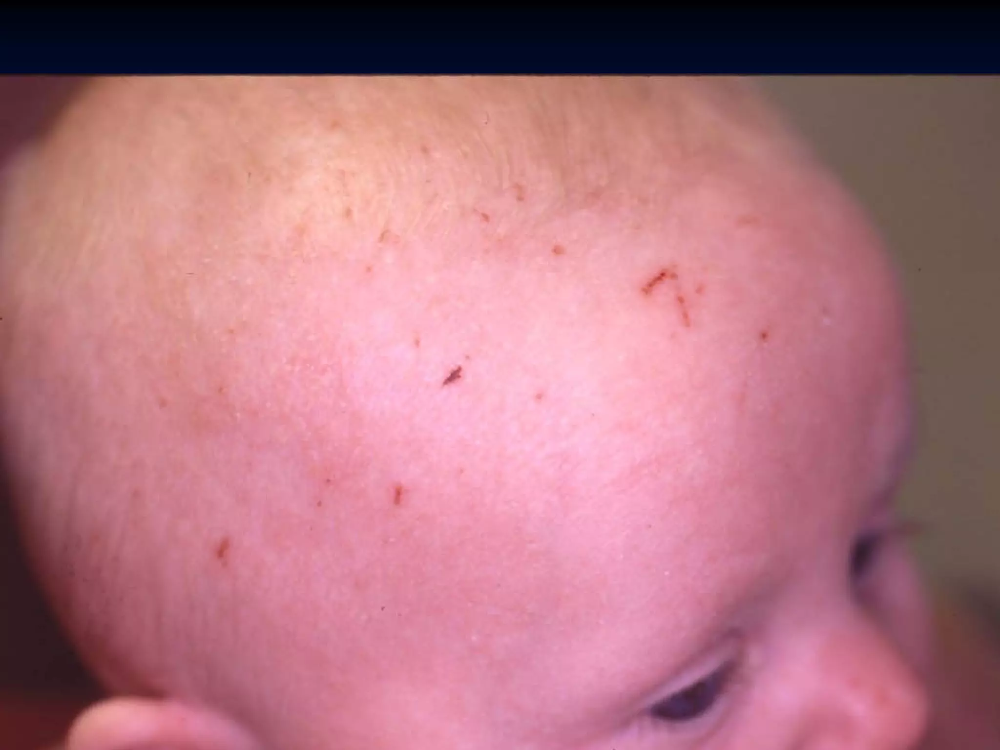 04. Common Pediatric Dermatology Diagnoses (Power Point Presentation ...