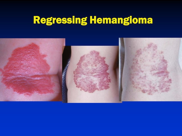 04. Common Pediatric Dermatology Diagnoses (Power Point Presentation ...