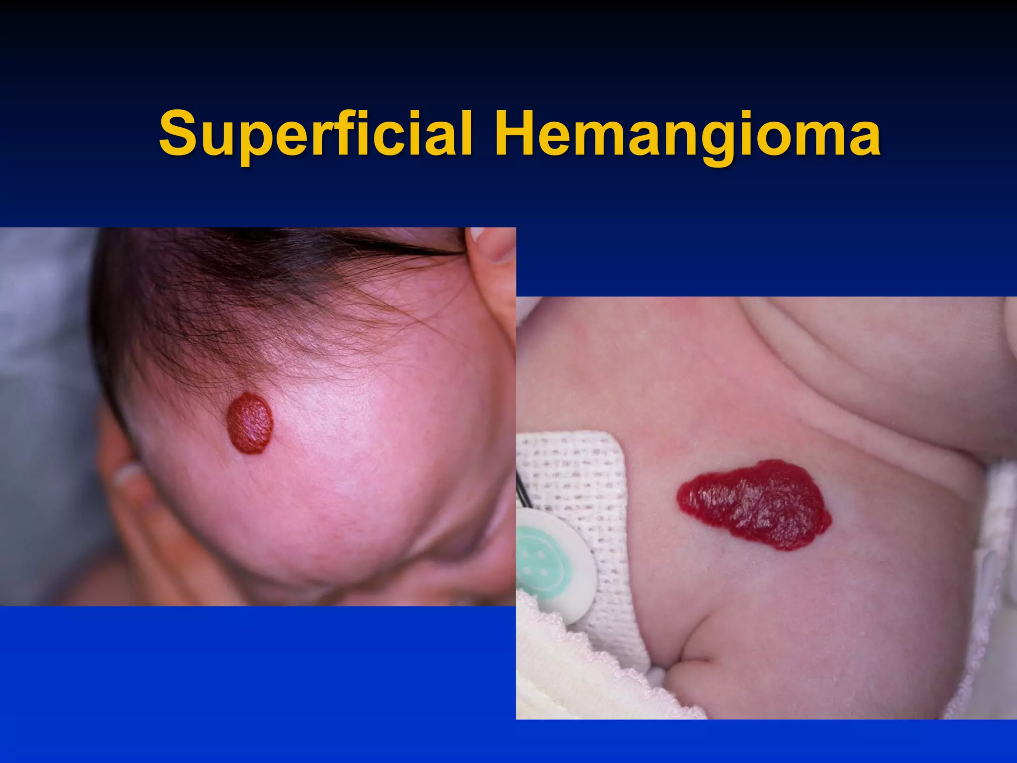 04. Common Pediatric Dermatology Diagnoses (Power Point Presentation ...