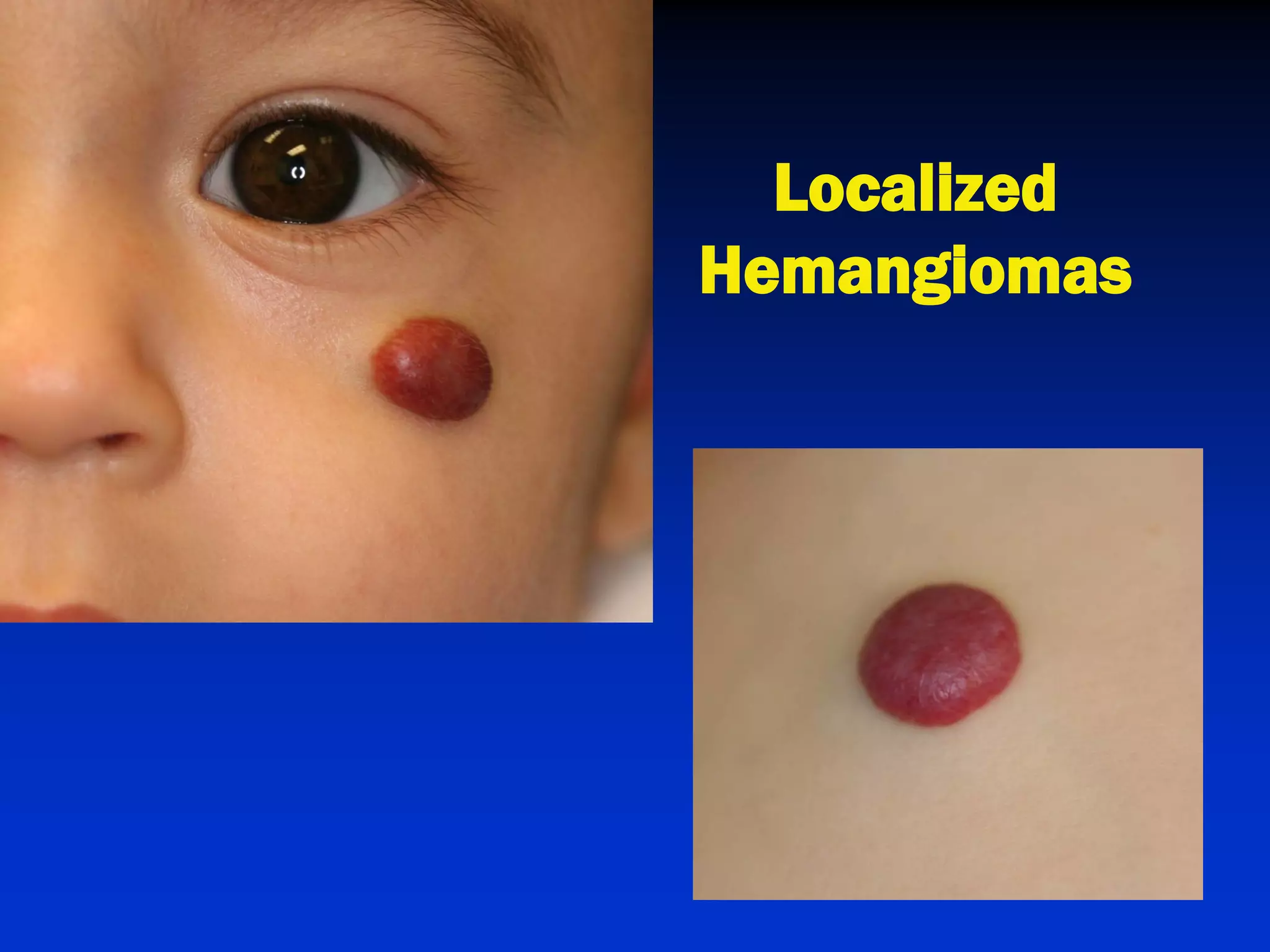 04. Common Pediatric Dermatology Diagnoses (Power Point Presentation ...