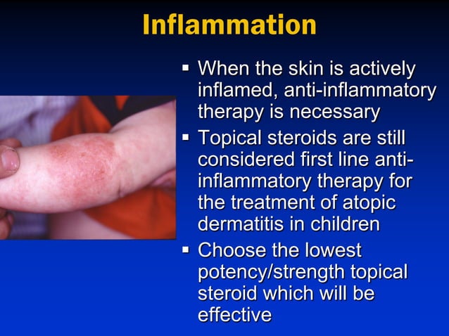 04. Common Pediatric Dermatology Diagnoses (Power Point Presentation ...